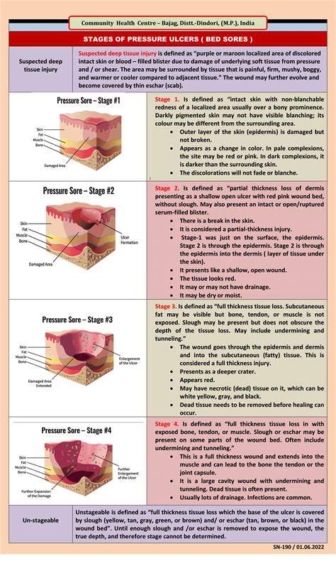 Medical Notes For Students Pressure Ulcers Stages