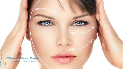 Ellansé Relleno Facial