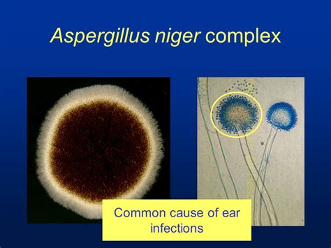 Aspergillus Niger Ear