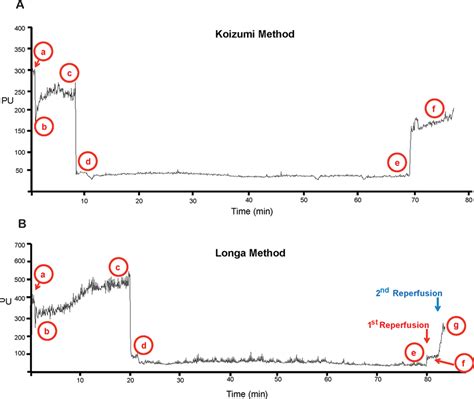 Representative Laser Doppler Flowmetry During Koizumi Or Longa