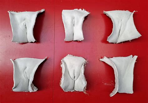 Poster Excision Infibulation And Clitoral Re Exposition Sex Ed