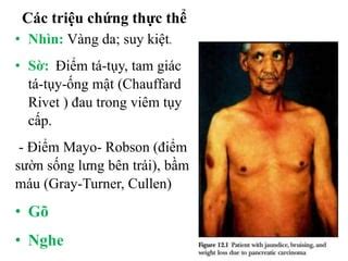 TriỆu ChỨng HỌc TỤy LÁchpptx