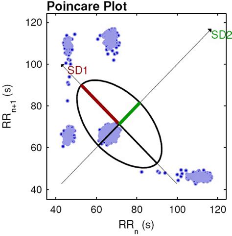 Poincare Plot For Abnormal Rhythm 119mat B Comparison Download