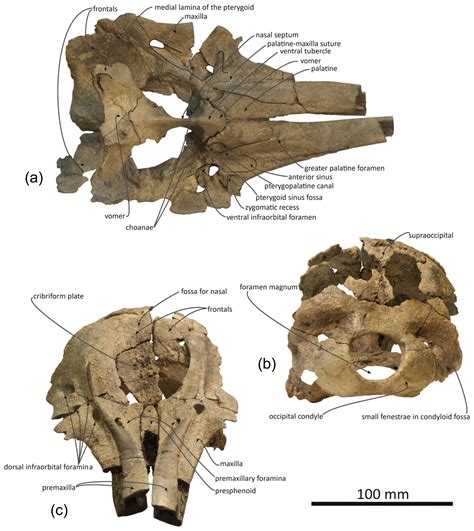Choanae Skull