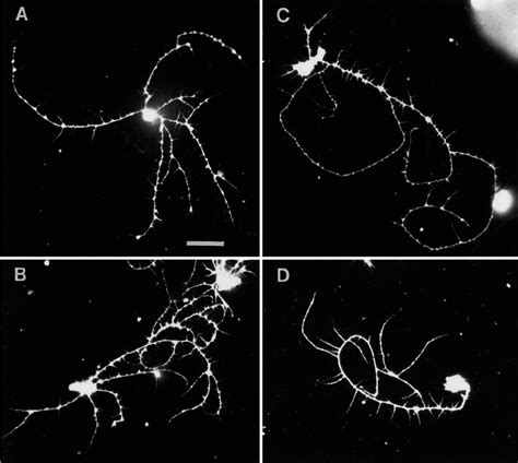 Histograms Depicting The Distributions Of Total Neurite Length A