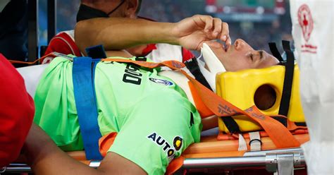 Juan Musso Publicó Una Imagen En Sus Redes Y Mostró Las Consecuencias