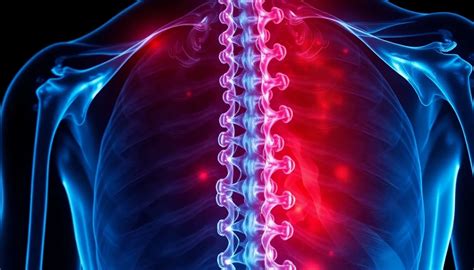 Why X Rays Arent Enough Diagnosing Herniated Discs With The Right Tools