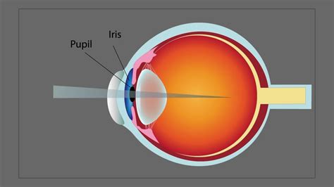 Artstation Presbyopia Instructional Animation