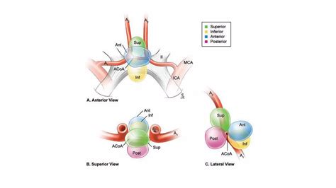 Subarachnoid Hemorrhage Sah And Aneurysm Presentationpptx