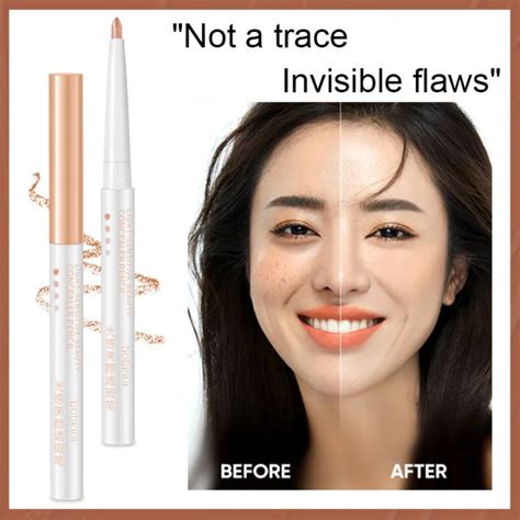 Dm Spot Acne Marks Repair Face Dark Circles Nasolabial Freckles Lying