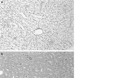 Sections Of Liver From Hatcheryreared Juvenile Winter Download