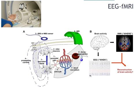 14 7 eeg fmri bs2010 bioimaging