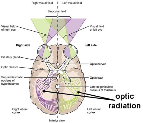 Optic Tract Vs Optic Radiation At Georgia Lai Blog