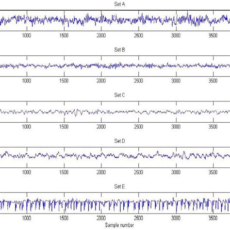 Five Level Wavelet Decomposition Of The Eeg Signal Download