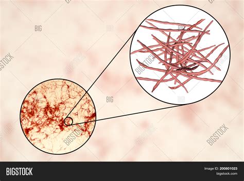 Actinomycetes Gram Image And Photo Free Trial Bigstock