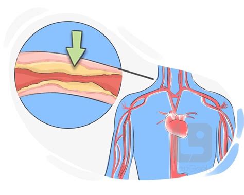Definition And Meaning Of Cholesterin Langeek