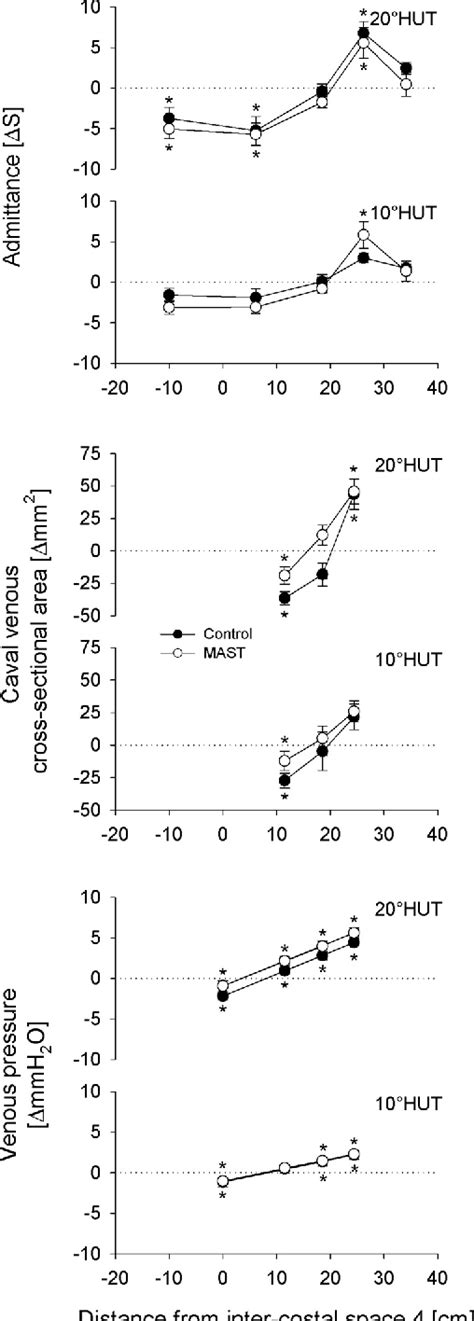 Figure 1 From The Hydrostatic Pressure Indifference Point