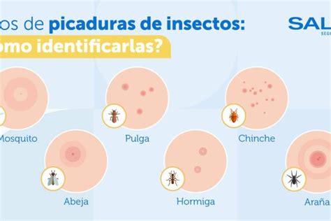 Conoce Los Diferentes Tipos De Bacterias En El Est Mago Y Sus S Ntomas Biblioteca Escolar