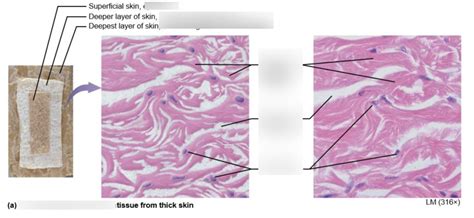 Dense Irregular Connective Tissue Diagram Quizlet