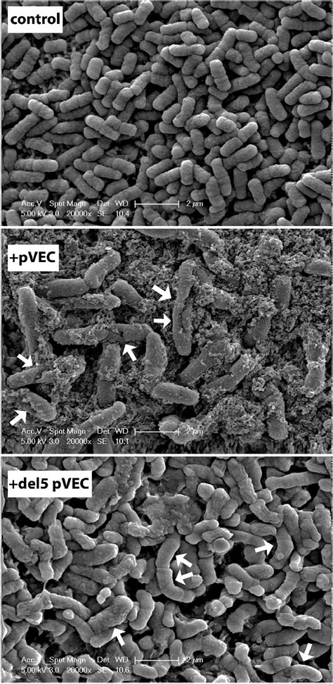 sem imaging of e coli cells on membrane filters untreated e coli