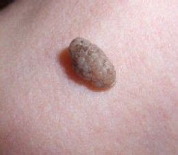 Pin On Health