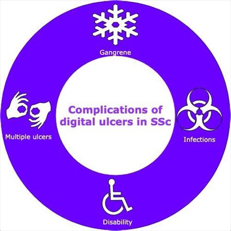 Digital Ulcers In Systemic Sclerosis Revista Colombiana De