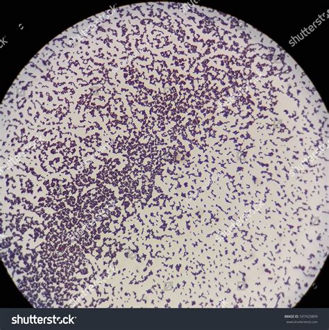 Coccus Bacteria Under Microscope