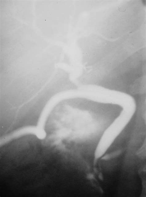 Biliary Anomalies Surgery Photos