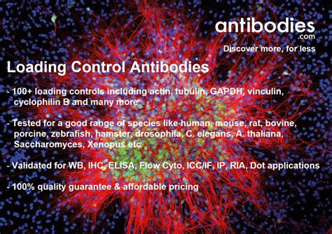 Loading Control Antibodies Are Used To Confirm That Protein Loading Is