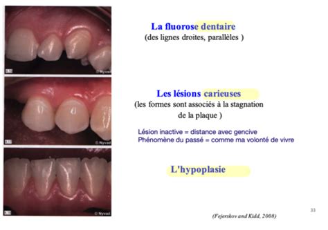 A 4 Maturation De Lémail Cartes Quizlet
