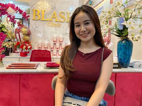 Mayang Lucyana Fitri Ungkap Masalah Jerawat Di Acara Klinik Kecantikan Milik Aktor Sigit Antonio