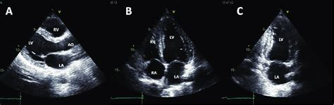 Echocardiographic Views Selected For The Focused Echocardiogram A