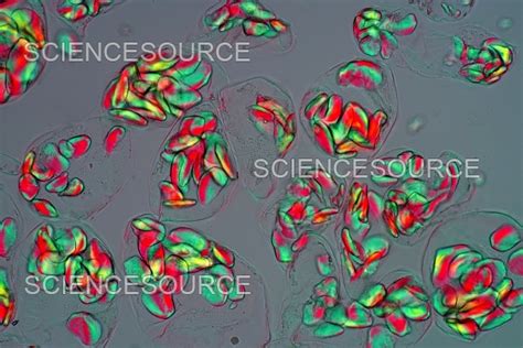Banana Starch Grains Light Micrograph Stock Image Science Source
