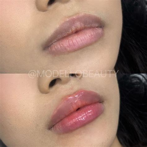 Bb Lip Reshaping Beauty And Personal Care Face Face Care On Carousell