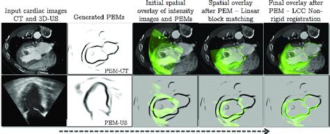 an example of multi modality cardiac image registration here a
