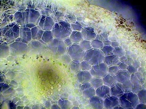 Xylem Cell Under Microscope