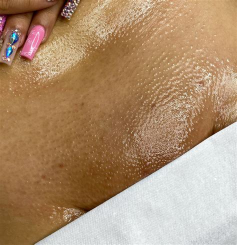 Brazilian Wax Before And After Tagged Wax Junkie Page 3