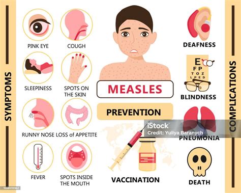 Measles Infographic Concept Vector Infected Human With Papules On The