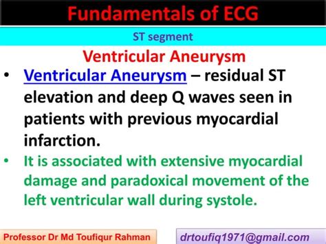 Approach To A Patient With St Segment Abnormality In Ecg Ppt Approach To A Patient With St Segment Abnormality In Ecg Ppt