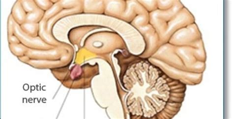 Pituitary Tumors Brain