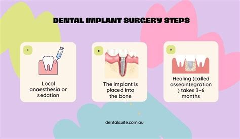 The Dental Implant Process Explained Dental Suite Australia