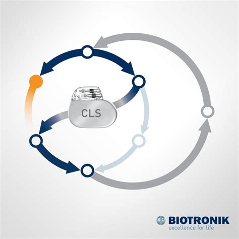 Biotronik On Linkedin Could Closed Loop Stimulation Improve The Lives