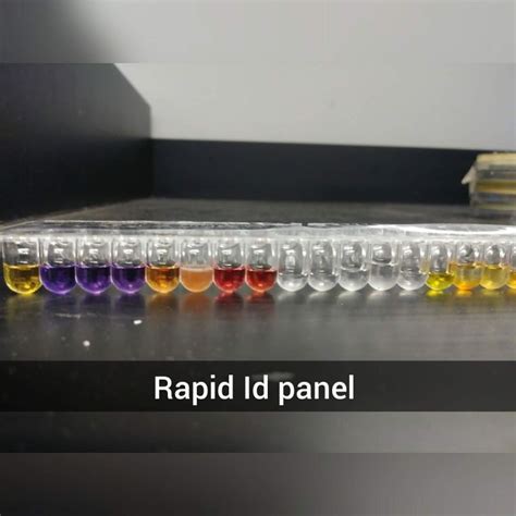 Mehreen Siddiqui On Linkedin Laboratorylife Biochemical Biotechnology