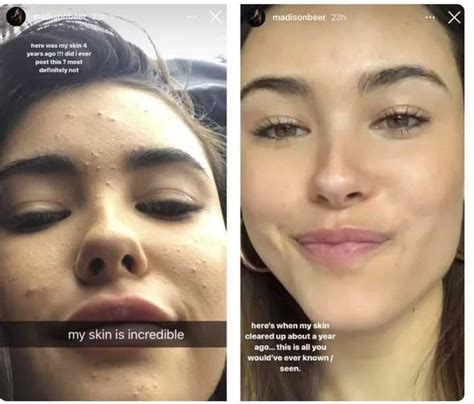 Madison Beer No Makeup Look 7 Photos Of Her Natural Beauty Ke