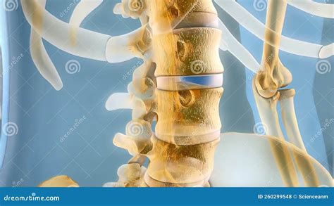 Sacral Nerve Stimulation Also Known As Sacral Neuromodulation Stock Illustration Illustration