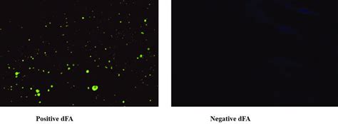 Direct Fluorescent Antibody Test Dfa Brain Impression Smears