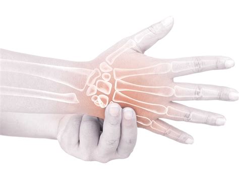 Is My Hand Broken Quiz Quiz Now