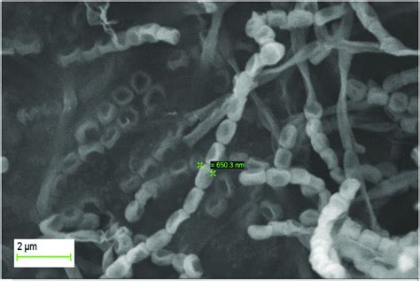 Scanning Electron Microscopic Image Of Spore Arrangement Download