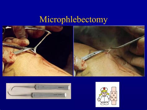 Management Of Incompetence In The Axial Veins Pptx
