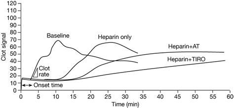 Sonoclot Signature Tracing From An Individual Experiment Baseline